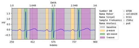 Python How Can I Make Certain Annotations Display In Wfdb Stack Overflow