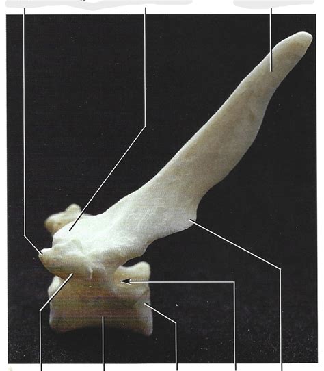 Thoracic Vertebrae Lateral View Diagram Quizlet