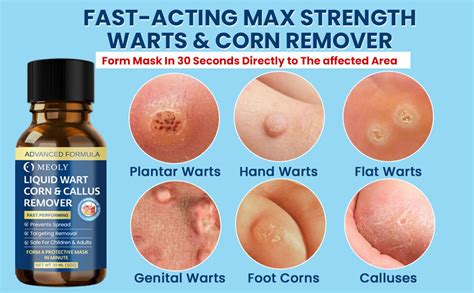 Meoly Fast Acting Wart Remover Freeze Off Salicylic Acid Wart Remover For Men Women Wart