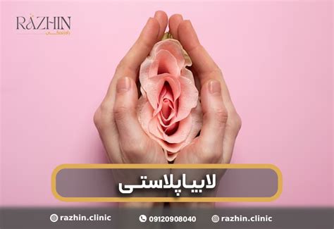 همه چیز درباره لابیاپلاستی یا عمل زیبایی واژن