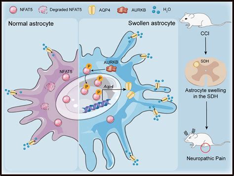 Inhibition Of Nfat5‐dependent Astrocyte Swelling Alleviates Neuropathic