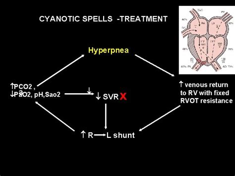 Cyanotic Spells Paroxysmal Hyperpnea Hypoxic Spells Anoxic Spells