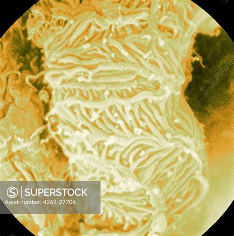 Glomerulus Scanning Electron Micrograph Sem Of A Glomerulus On The