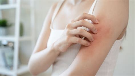 Dermatite Atopica Cause Sintomi E Diagnosi