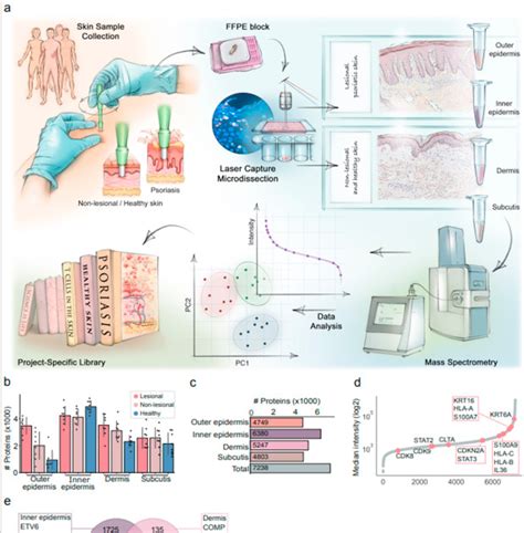 News In Proteomics Research Spatial Proteomics Across Laters Of Skins Investigates Psoriasis