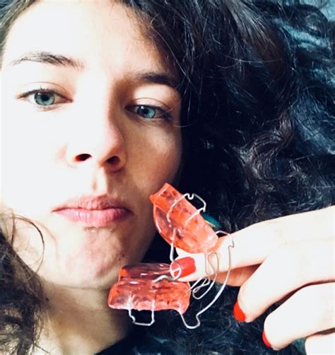 Real Braces Just For Fun