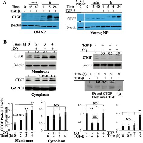 Tgf‐β Induces A Rapid Decrease In Cytoplasmic Ctgf Protein Levels In