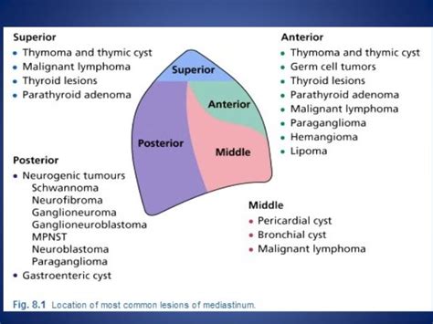 Mediastinal Syndrome