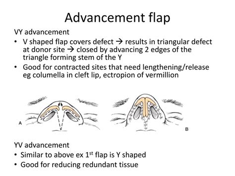Ppt Cummings Chap 24 Reconstruction Of Facial Defects Powerpoint Presentation Id2982802