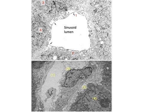 Liver Electron Micrograph Quiz