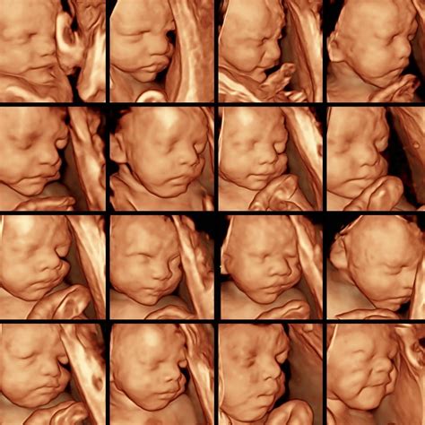 30 Weeks Pregnant 4d Ultrasound
