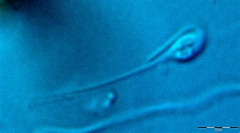 Possible New Termite Protist Species From A Termite In South Australia