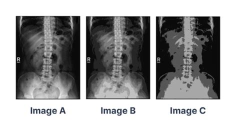 Bit Depth And Quantization Flashcards Quizlet