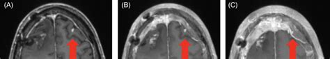 example of the three data sets left 1 mm images middle 5 mm mips and