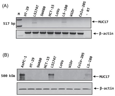 Expression Of Intestinal Muc17 Membrane Bound Mucin In Inflammatory And