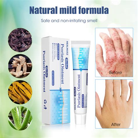 Psoriasis Antibacterial Ointment Topical Skin Ointment Inhibit Bacteria
