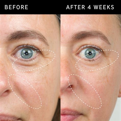 Ceramide Enriched Moisturizer To Restore And Hydrate Skin The Inkey List Eu
