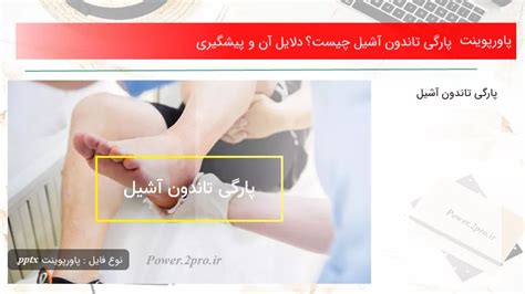 دانلود پاورپوینت پارگی تاندون آشیل چه چیزی است ؟ دلایل آن و پیشگیری