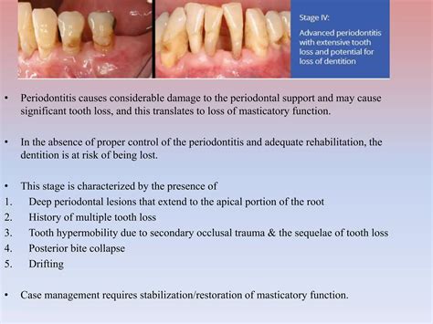 Periodontitis Pptx