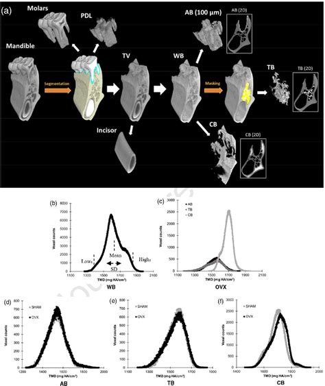 Figure 1 From Regional Variations Of Jaw Bone Characteristics In An