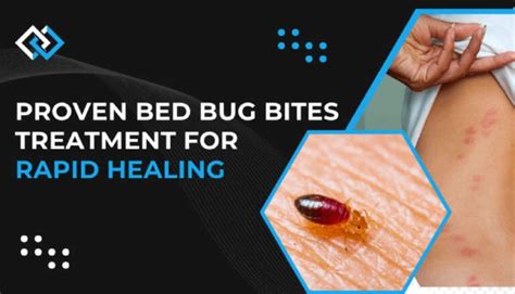 Proven Bed Bug Bite Treatment For Rapid Healing European Raptors
