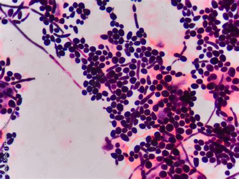Budding Yeast Gram Stain