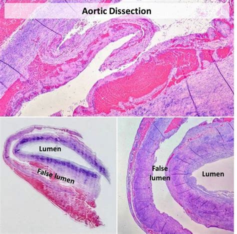 Pin On Forensic Pathology Microscopy