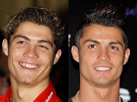 با الگوی لبخند رونالدو؛ فوتبالیست‌های ما برای نشان دادن دندان خود چه می‌کنند؟ خبرورزشی