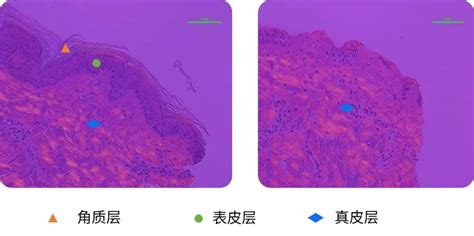 透皮给药制剂研究概况及其体内pk研究方法 药明康德dmpk