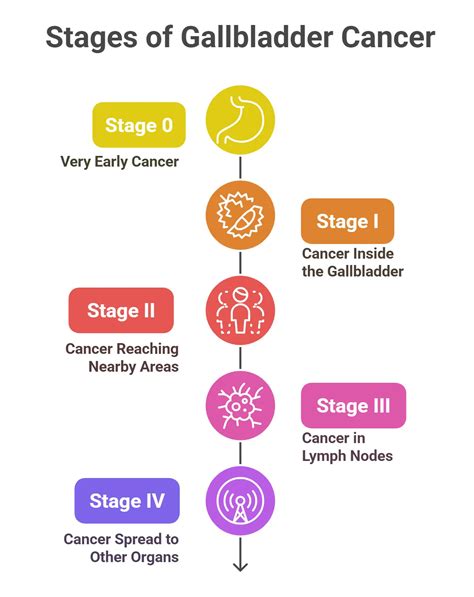 Gallbladder Cancer Signs Symptoms And Treatment Options
