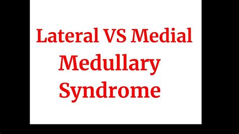 Medial Medullary Syndrome Usmle Click The Link In Our Bio To Find Demo