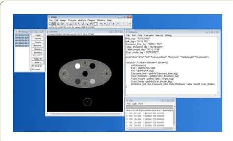 Figure 3 From Computed Tomography Ct Automatic Exposure Controls Aec
