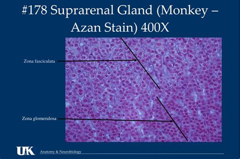 Ppt Lab Demo 18 Endocrine 2 Thyroid Gland Parathyroid Gland