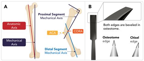 Osteotomies Indications Imaging Appearance Surgical Techniques And