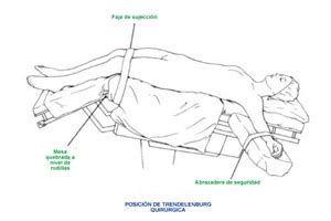 Posiciones Anatómicas Apuntes Auxiliar Enfermeria