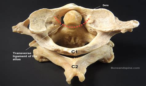Atlantoaxial Joint Diagram