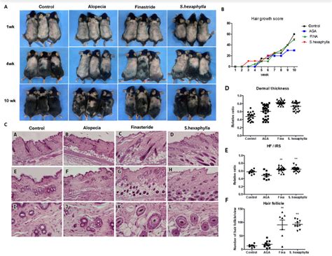 Testosterone Propionate Induced Androgenetic Alopecia Aga Model