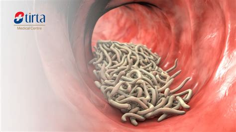 Vaksin Pneumonia Harga Tujuan And Jenis Jenisnya