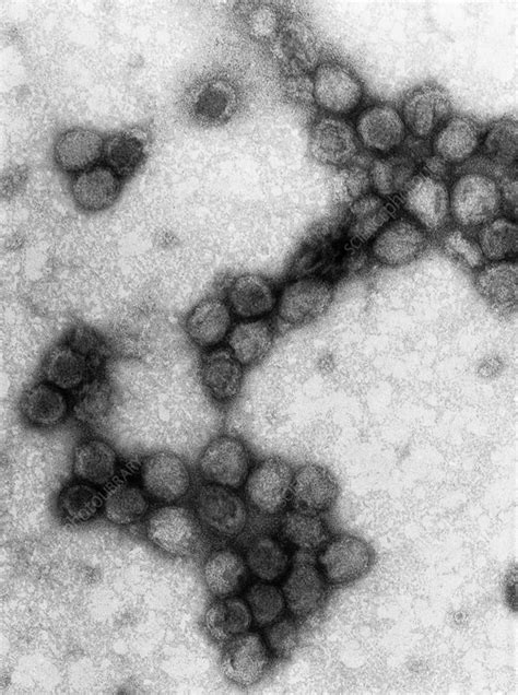 Tick Borne Encephalitis Virus Stock Image M050 0259 Science Photo Library