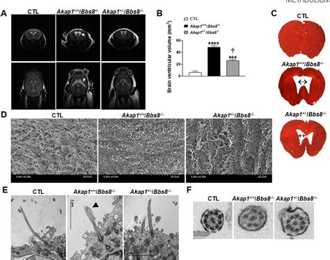 Figure 6 From The Bbsome Regulates Mitochondria Dynamics And Function