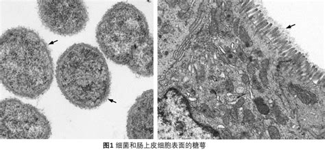 常规透射电镜超薄制片应怎样保存和显示糖萼 知乎