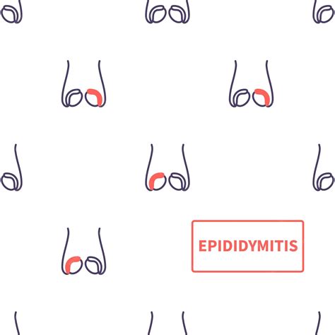 Premium Vector Epididymitis Disease Of Testicles Anatomy Medical Pattern