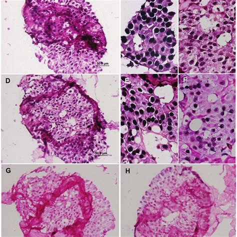 Typical Nested Pcr Amplification For Ebv Hpv And Mmtv A Ebv Pcr For Download Scientific