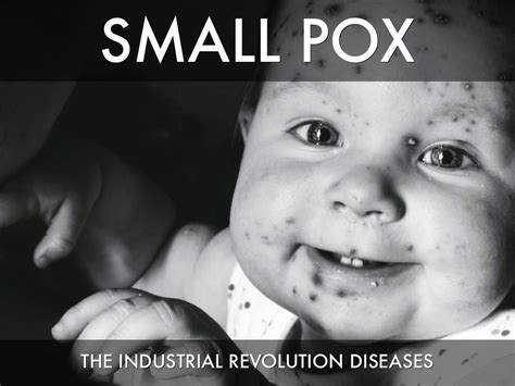 Small Pox By Jaylen Mahoney