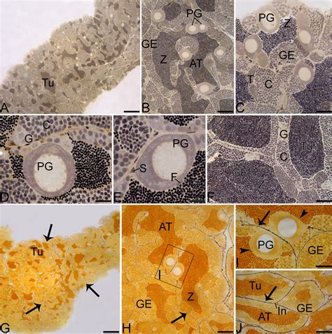 The Basement Membrane And The Sex Establishment In The Juvenile