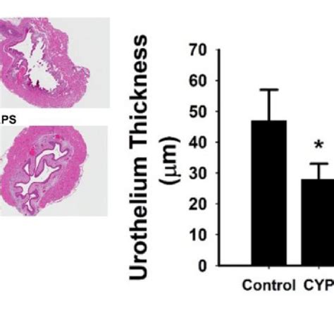 Histological Examination In Bladder Cross Sections By Hande Stain Between