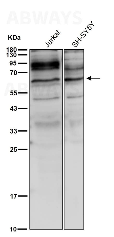 Antibody Products Abways