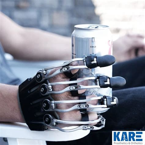 Passive Prosthetic Partial Hand Prosthesis Below The Elbow At Best Price In Bengaluru