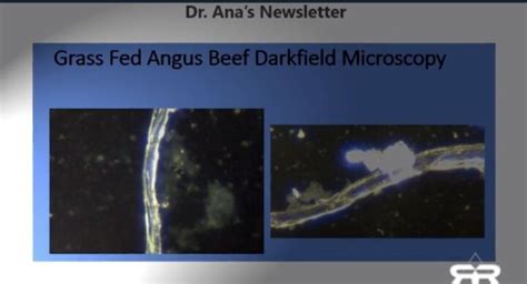 Dr Annas Microscopy Grass Fed Angus Beef09042023 Synthetic Agenda