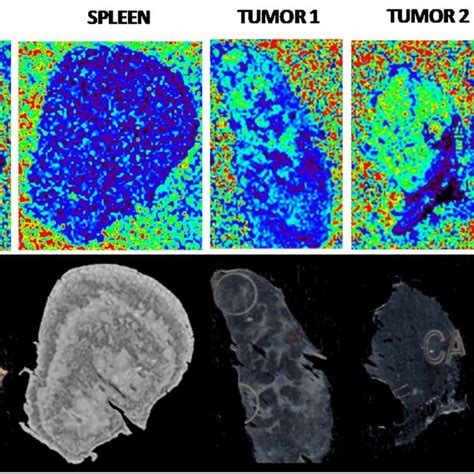 Ion Suppression Effect On The D5 Ptx Ion Signal Mz 2892 Of